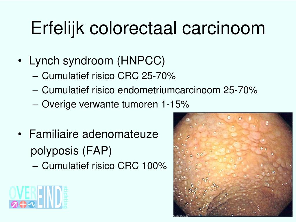 PPT - Bevolkingsonderzoek Darmkanker PowerPoint Presentation, free ...