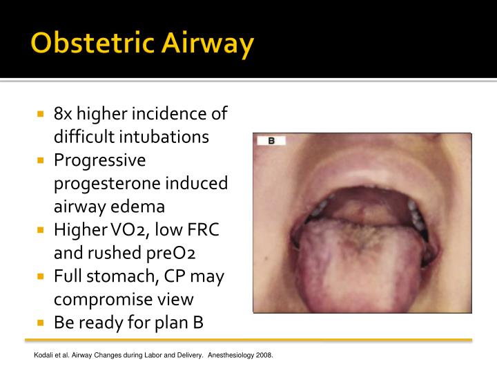 PPT - Anesthesia for Cesarean Section PowerPoint Presentation - ID:3407705