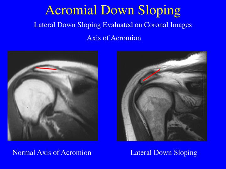 PPT - MR Imaging of the Rotator Cuff PowerPoint Presentation - ID:3407771