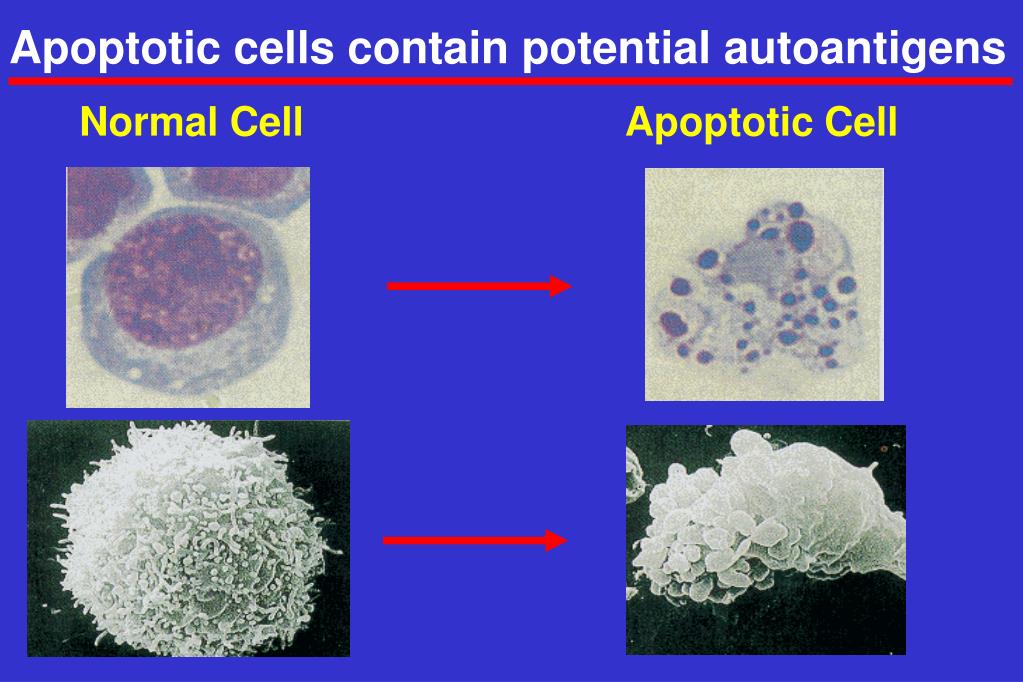 Ppt Apoptotic Cell Clearance And The Resolution Of Inflammation