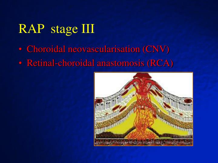 PPT - RAP PowerPoint Presentation - ID:3409923