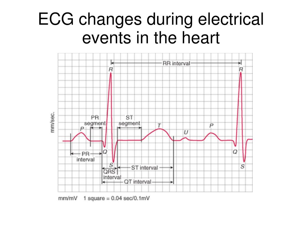 PPT - Heart Anatomy and Arrhythmias Overview PowerPoint Presentation ...