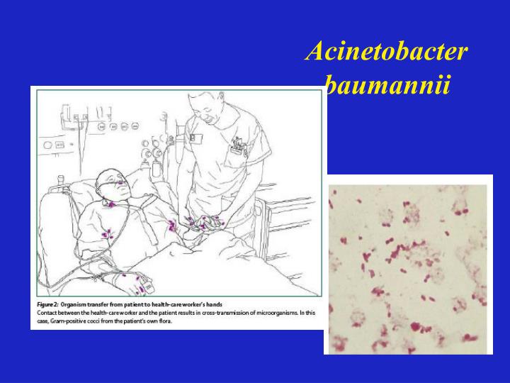 PPT - Acinetobacter baumannii PowerPoint Presentation, free download ... PPT - Acinetobacter baumannii PowerPoint Presentation, free download ...