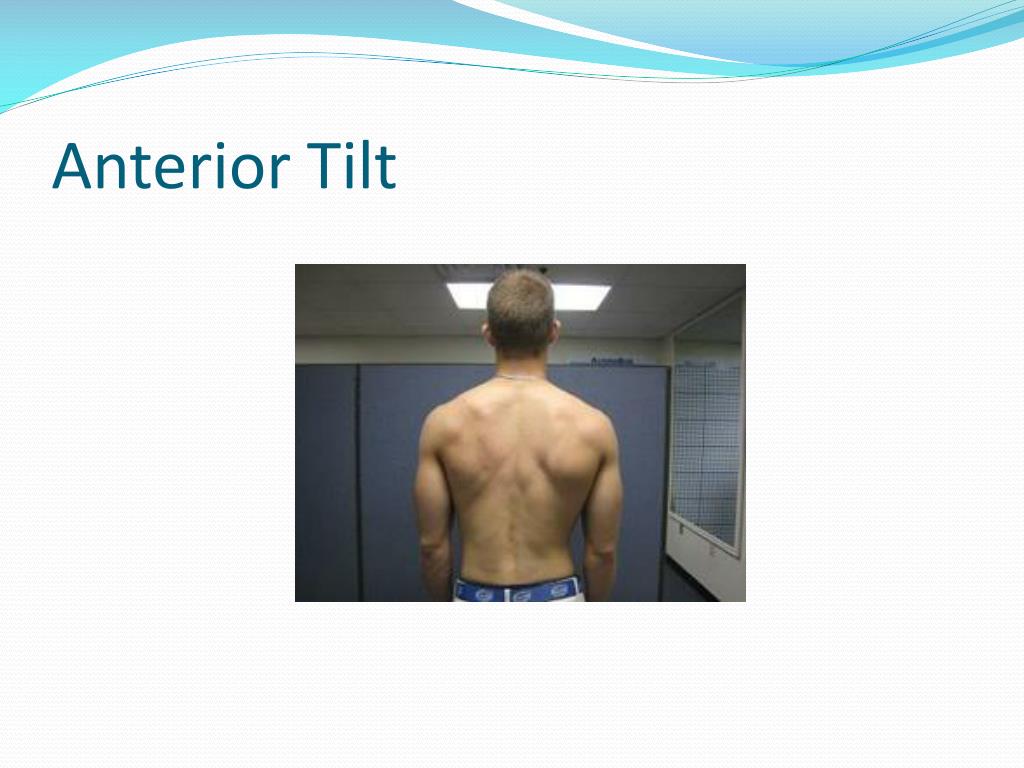 PPT - Assessment of Shoulder Pain PowerPoint Presentation, free ...