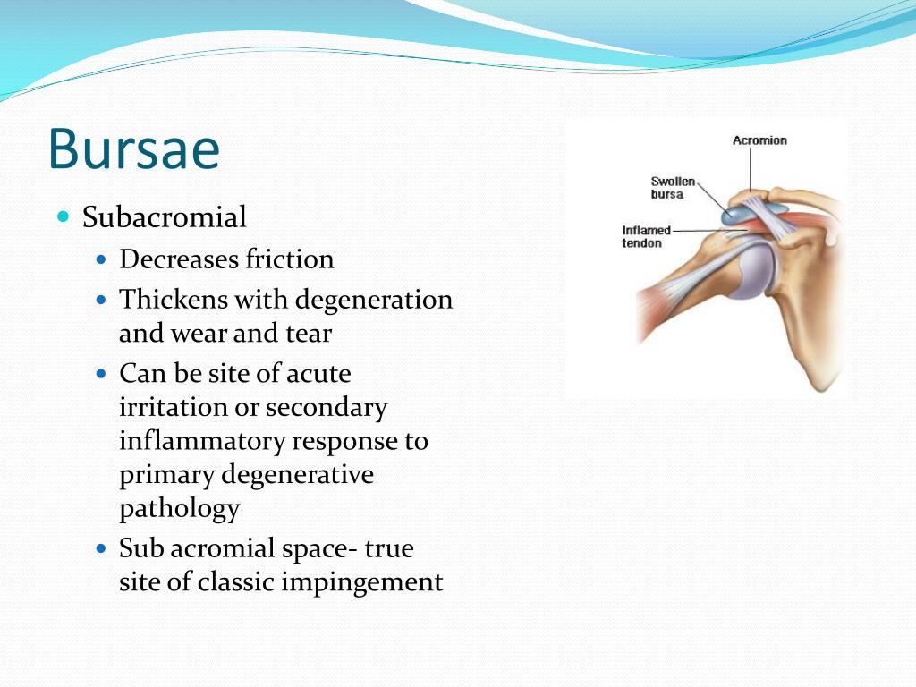 PPT - Assessment of Shoulder Pain PowerPoint Presentation, free ...