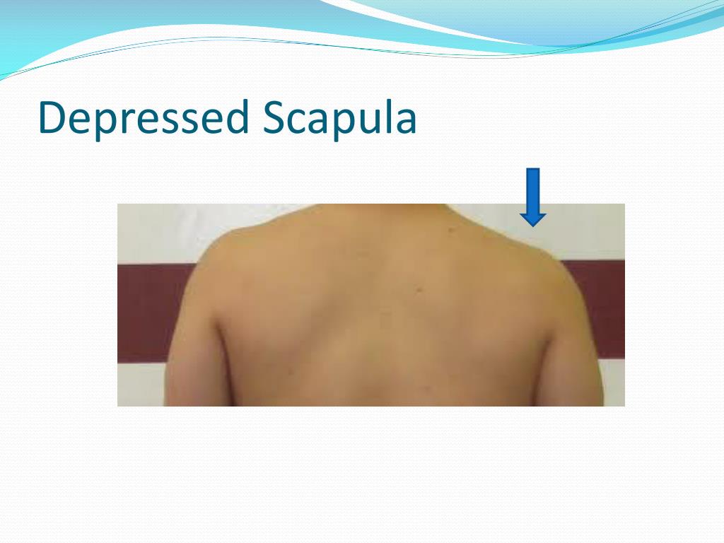 PPT - Assessment of Shoulder Pain PowerPoint Presentation, free ...
