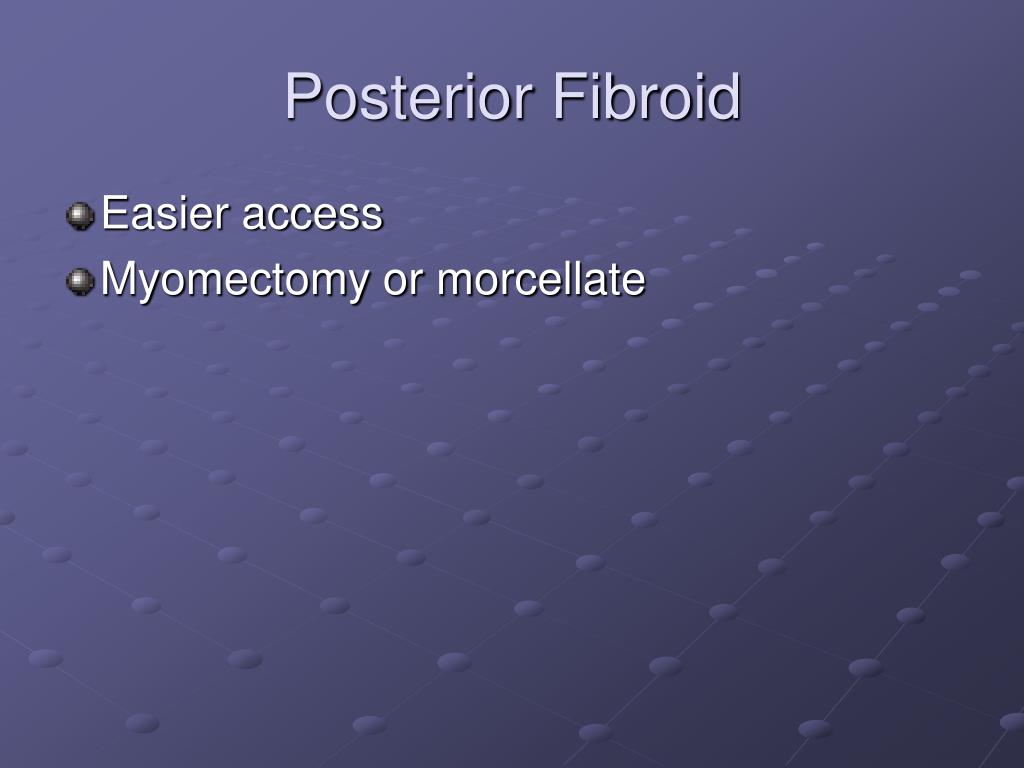 PPT - VAGINAL HYSTERECTOMY FOR BIG UTERI PowerPoint Presentation, free ...