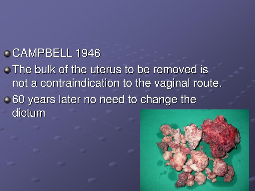 Ppt Vaginal Hysterectomy For Big Uteri Powerpoint Presentation Free