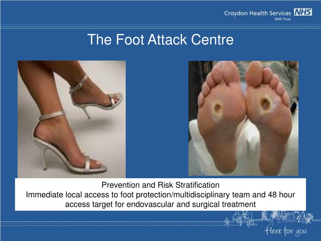 PPT - London Diabetes Foot Care Network PowerPoint Presentation, free ...