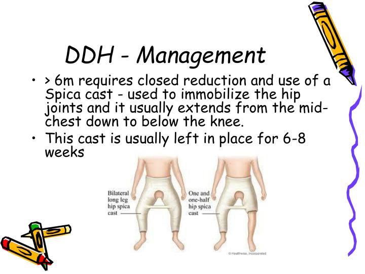 PPT - The Limping Child PowerPoint Presentation - ID:3415356