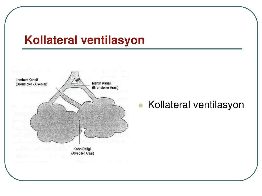 PPT - Havayolu klirensi bozuk hastaya yaklaşım PowerPoint Presentation - ID:3416687