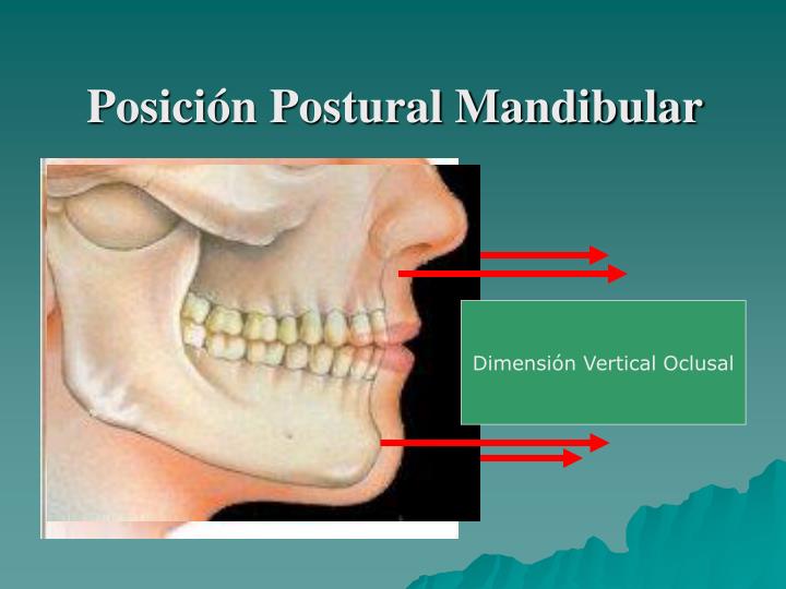 PPT - Posiciones Mandibulares Básicas PowerPoint Presentation - ID:3417105
