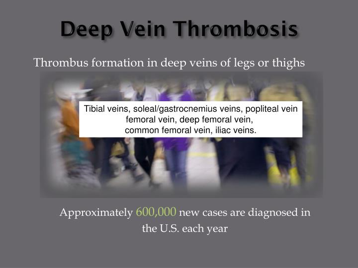 PPT - Deep Vein Thrombosis PowerPoint Presentation, free download - ID ...