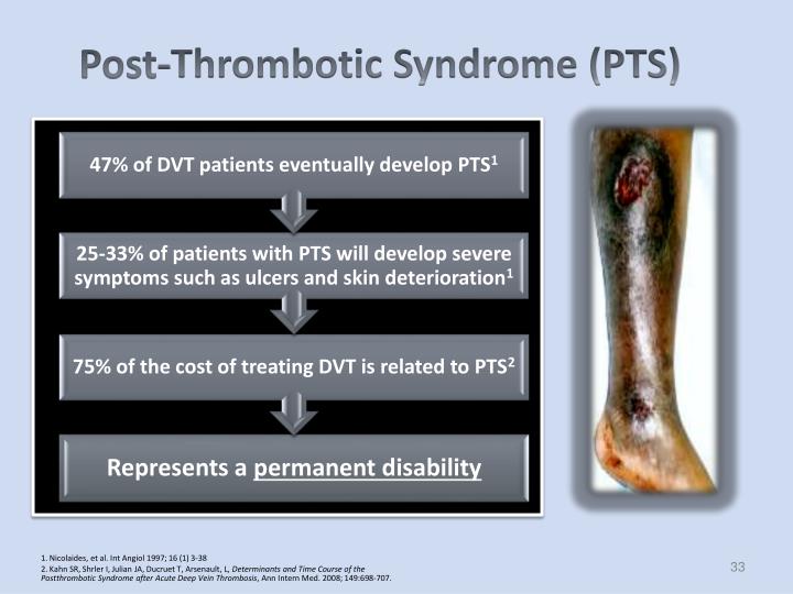 PPT - Endovascular Treatment for Patients with Deep Vein Thrombosis ...