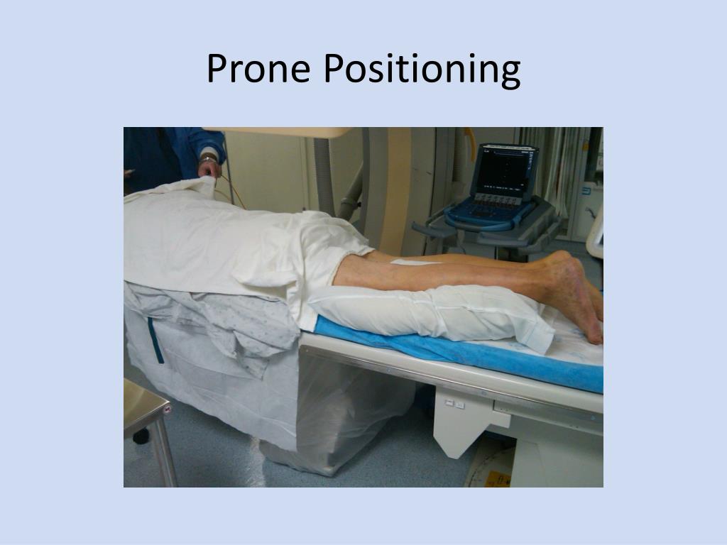 PPT - Endovascular Treatment for Patients with Deep Vein Thrombosis ...