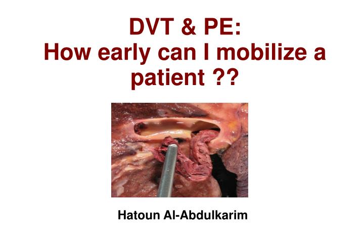 PPT - DVT & PE: How early can I mobilize a patient ?? PowerPoint ...