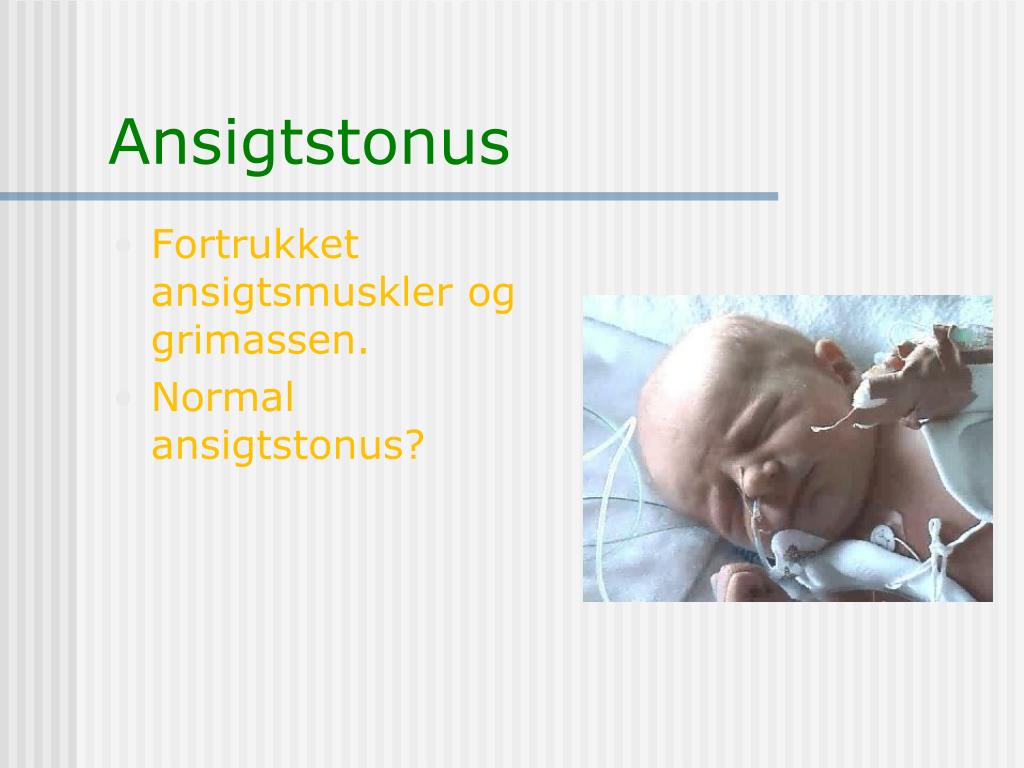 PPT - Smertevurdering af nyfødte COMFORTneo PowerPoint Presentation ...