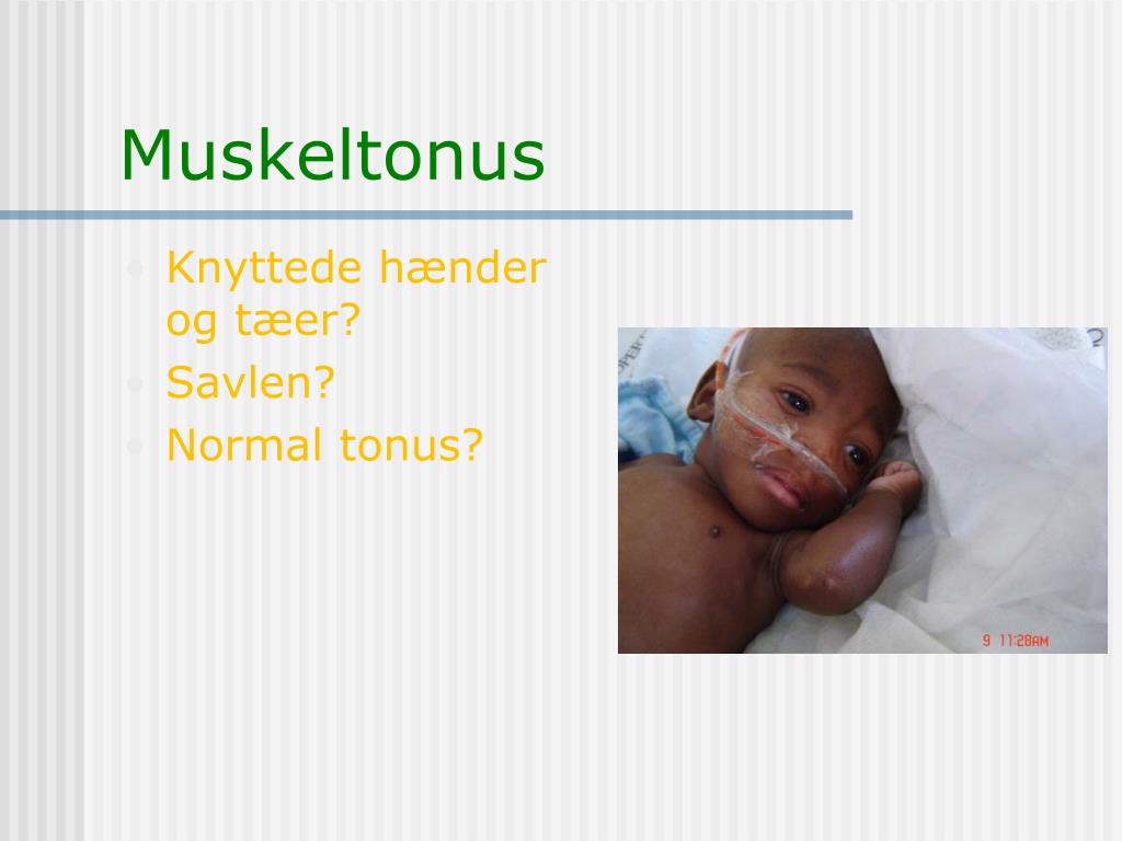 PPT - Smertevurdering af nyfødte COMFORTneo PowerPoint Presentation ...