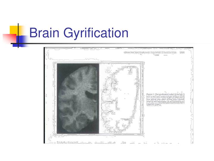 PPT - DYSLEXIA and the BRAIN PowerPoint Presentation - ID:3420845