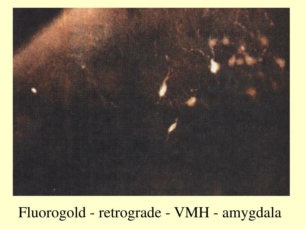 PPT - Neuroanatomical techniques Golgi - whole neuron Nissl - (cresyl ...