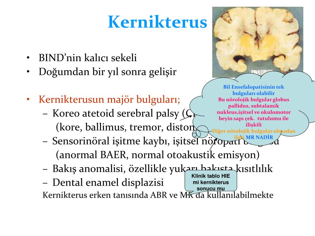 PPT - Kocaeli Üniversitesi Tıp Fakültesi Çocuk Sağlığı ve Hastalıkları ...