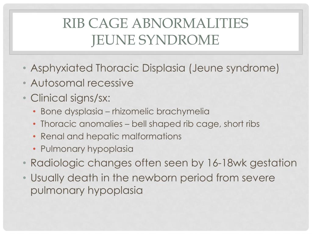 PPT - Respiratory distress In the full term neonate PowerPoint ...