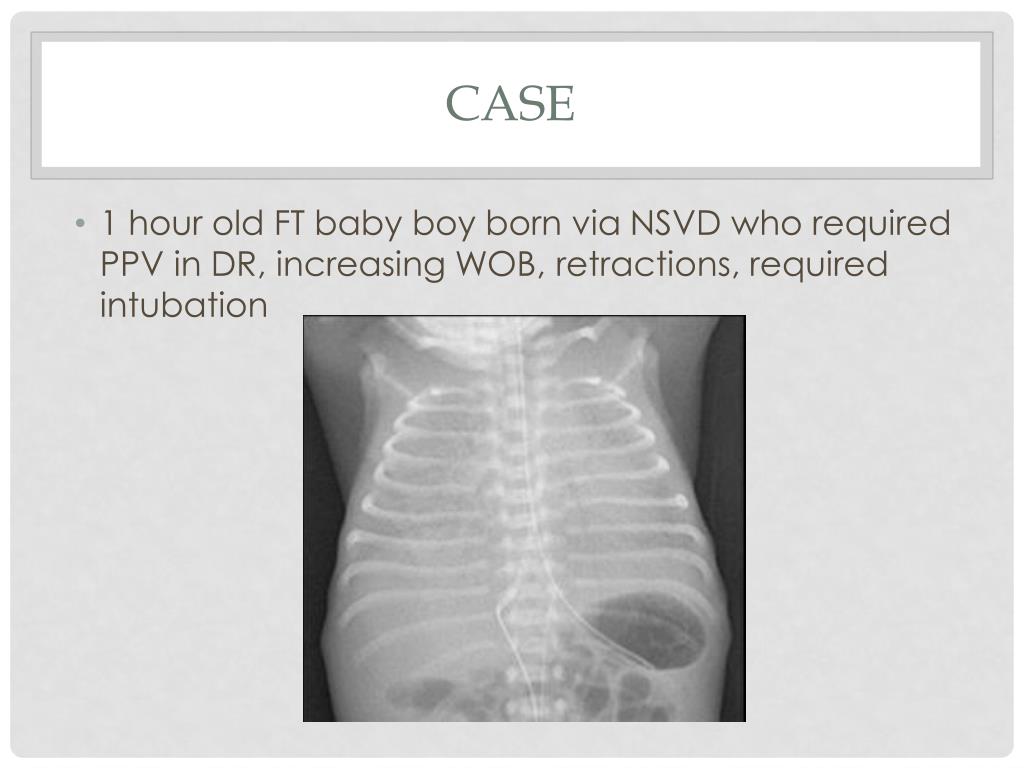 PPT - Respiratory distress In the full term neonate PowerPoint ...