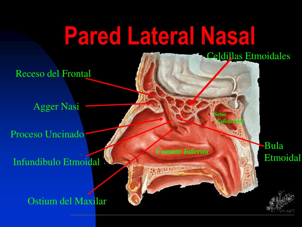 PPT - Patología de Nariz y SPN PowerPoint Presentation, free download ...