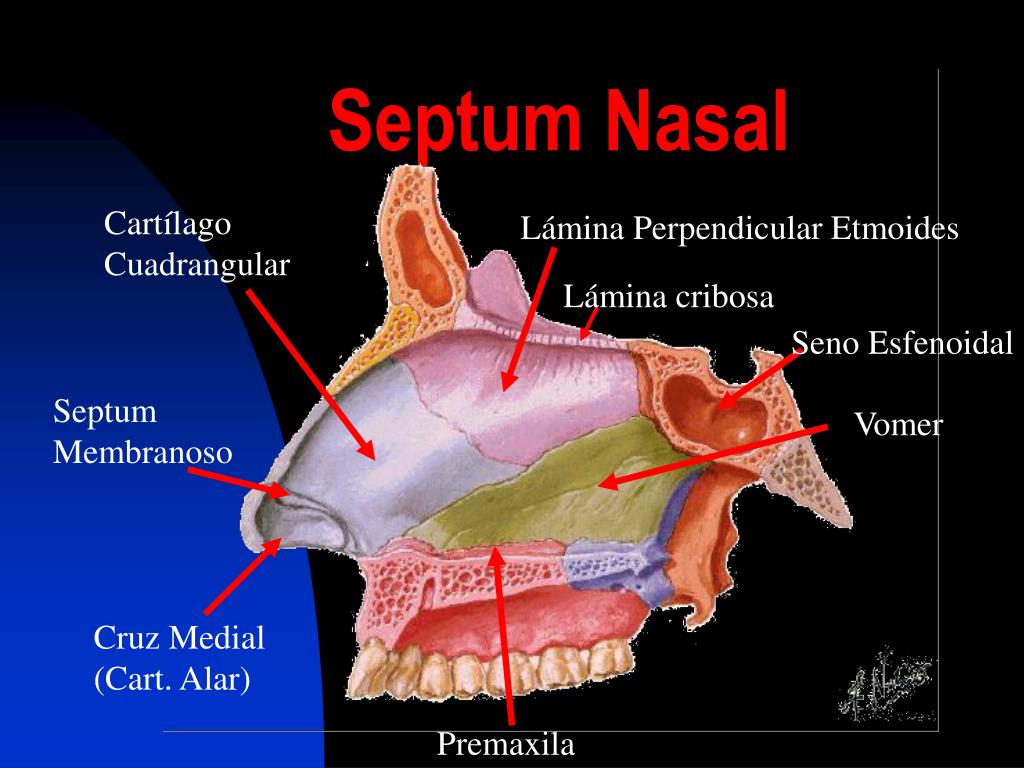 PPT - Patología de Nariz y SPN PowerPoint Presentation, free download ...