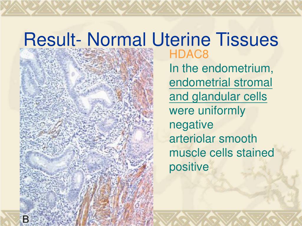 PPT - Laurence de Leval, MD, PhD,* David Waltregny, MD, PhD,w Jacques ...