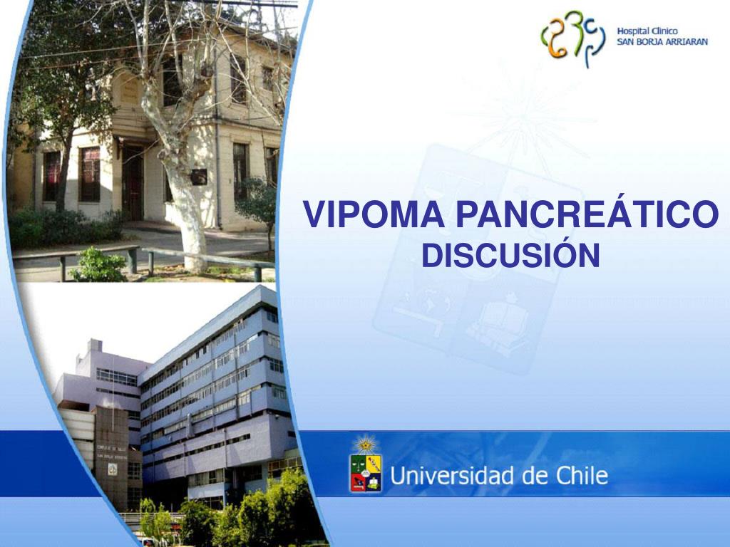 PPT - VIPOMA PANCREÁTICO CASO CLÍNICO PowerPoint Presentation, free ...