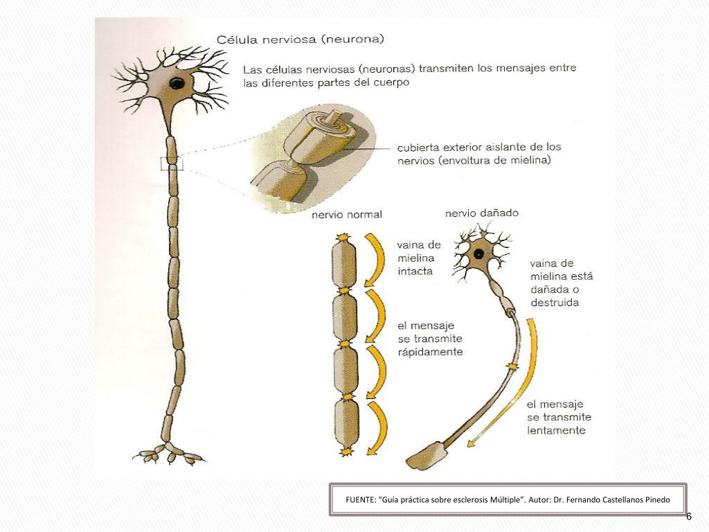 PPT - INTERVENCIÓN DESDE LA FISIOTERAPIA EN PACIENTES CON ESCLEROSIS ...