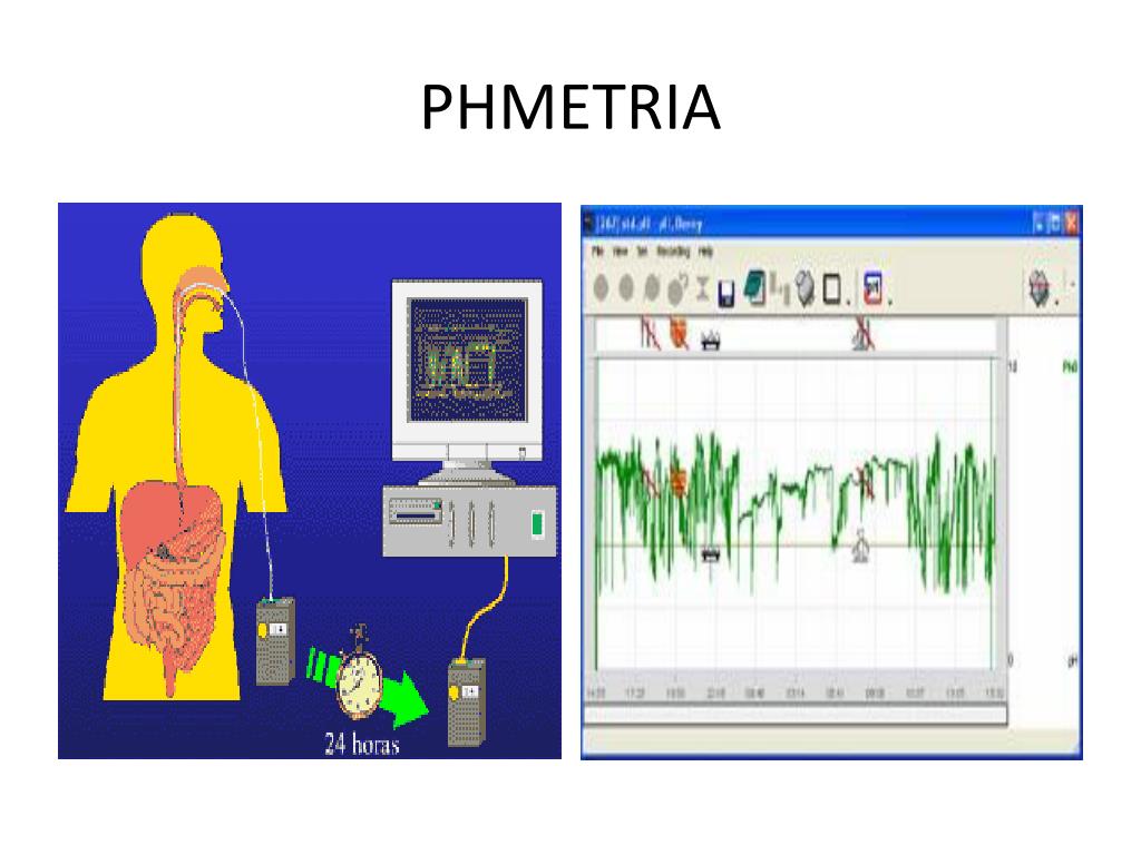 PPT - Fisiopatología del esófago PowerPoint Presentation, free download ...