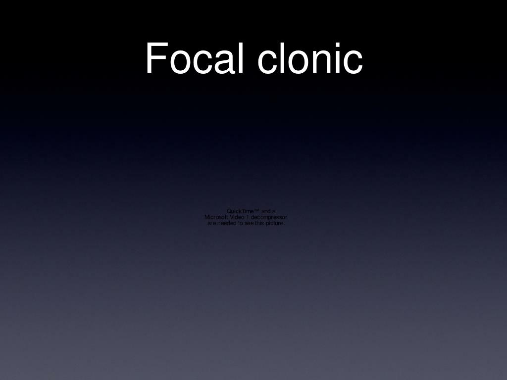 PPT - Diagnosis & Treatment of Pediatric Epilepsy PowerPoint ...