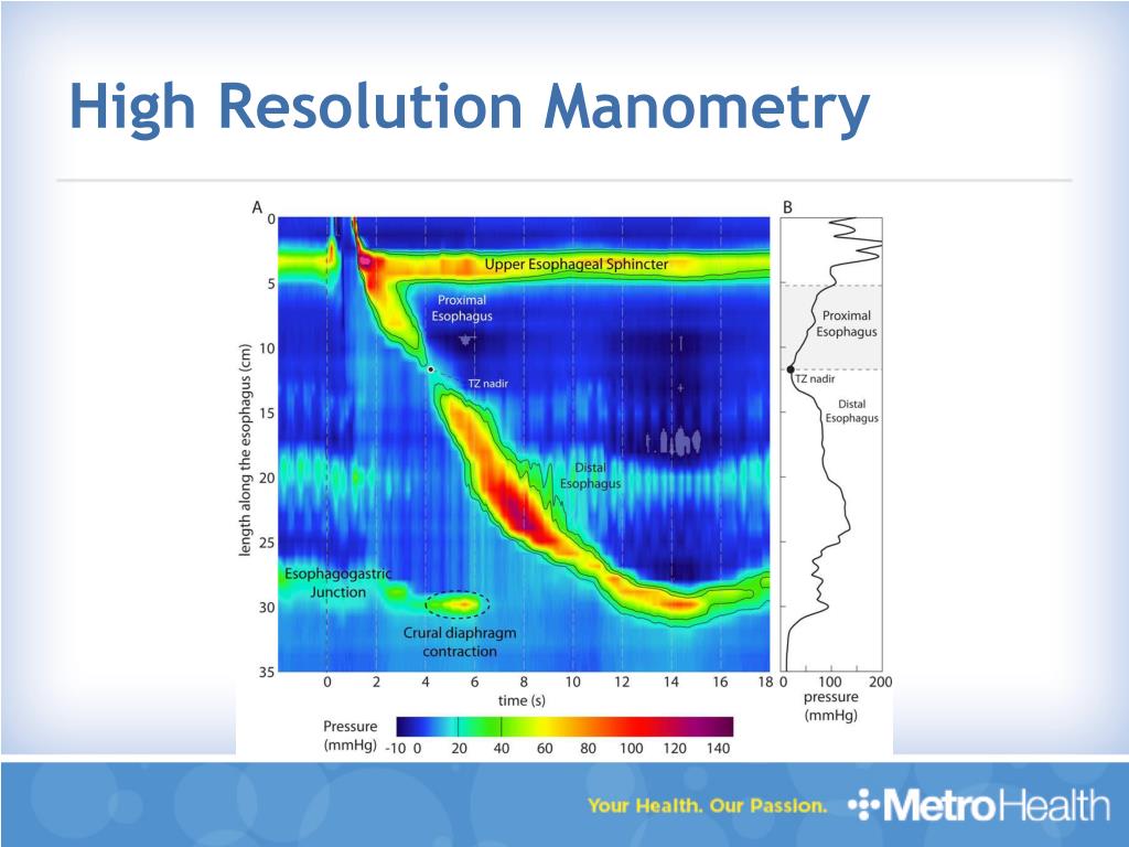 PPT - Non-cardiac Chest Pain PowerPoint Presentation, free download ...