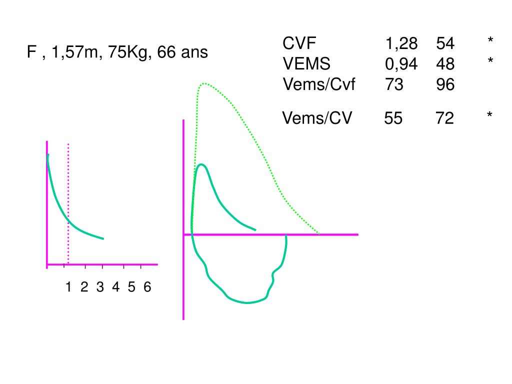 PPT - Pneumologie: LES EPREUVES FONCTIONNELLES RESPIRATOIRES PowerPoint ...