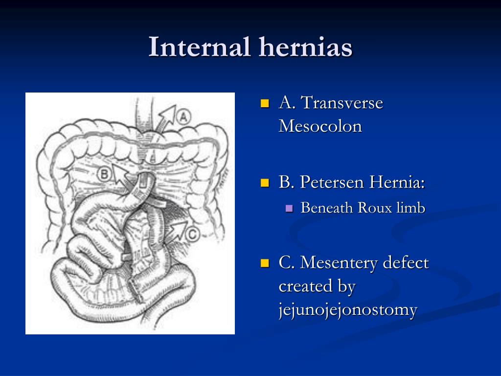 PPT - Perioperative Care of the Bariatric Patient PowerPoint ...
