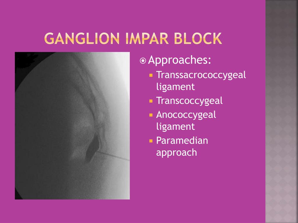 PPT - Interventional Approaches to pelvic pain in women PowerPoint ...