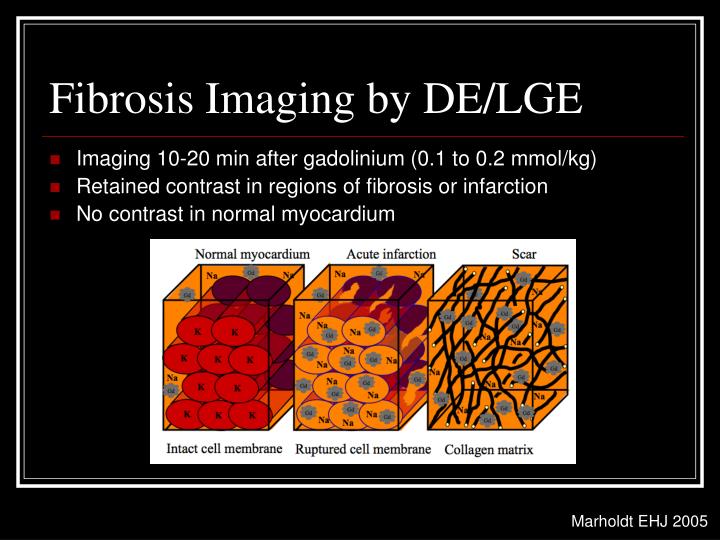 PPT - CMR of Non-ischemic Dilated and Restrictive Cardiomyopathies ...