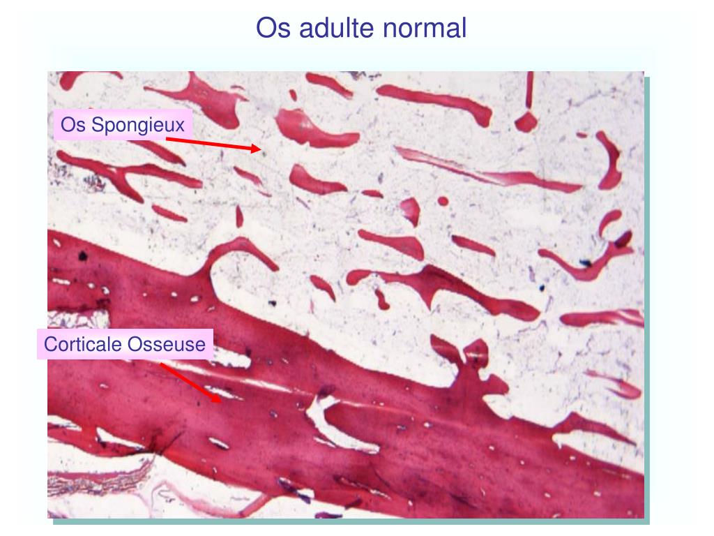 PPT - Remodelage osseux Aspects biologiques et moléculaires PowerPoint ...