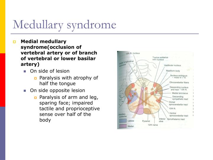 PPT - Seminar on… Territorial Localization and Management of Stroke ...