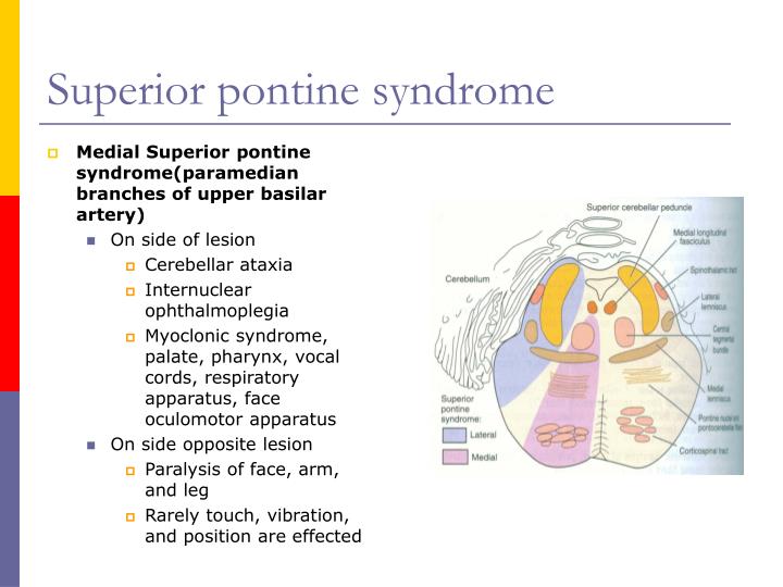 PPT - Seminar on… Territorial Localization and Management of Stroke ...