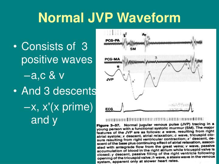 PPT - Jugular Venous Pulse PowerPoint Presentation - ID:3431335