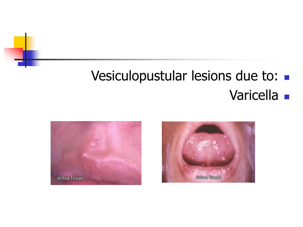 PPT - INTRODUCTION TO ORAL AND DENTAL DISEASES PowerPoint Presentation ...