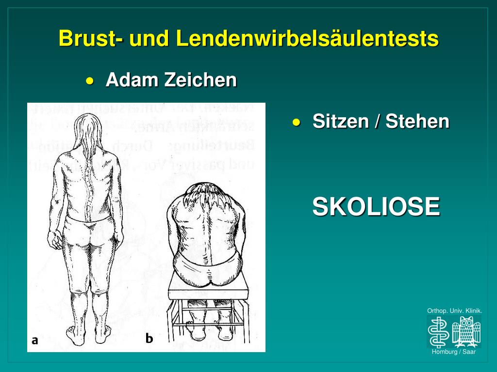 PPT - Orthopädischer Untersuchungskurs Wirbelsäule F. Bachelier, E ...