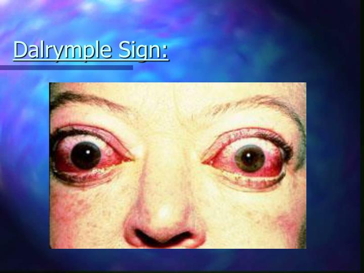 PPT - Thyroid Eye Disease & Other Orbital Conditions PowerPoint ...