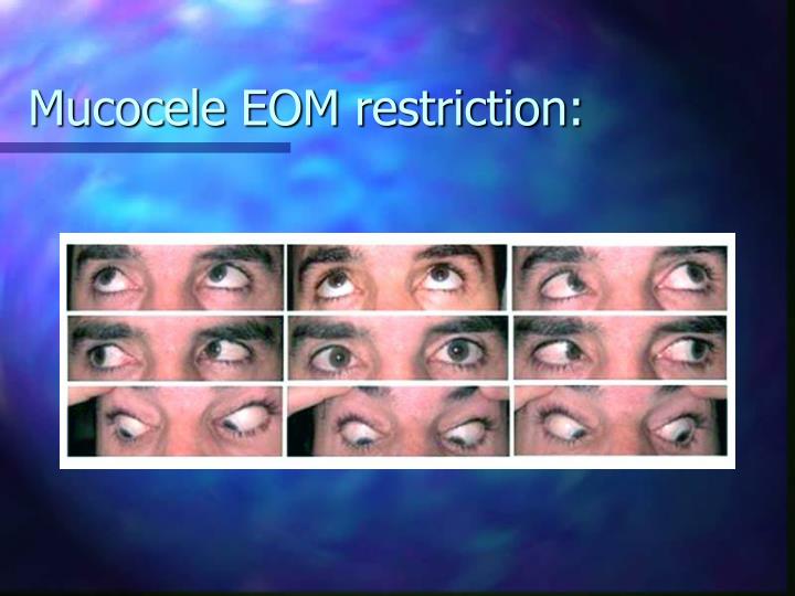 PPT - Thyroid Eye Disease & Other Orbital Conditions PowerPoint ...
