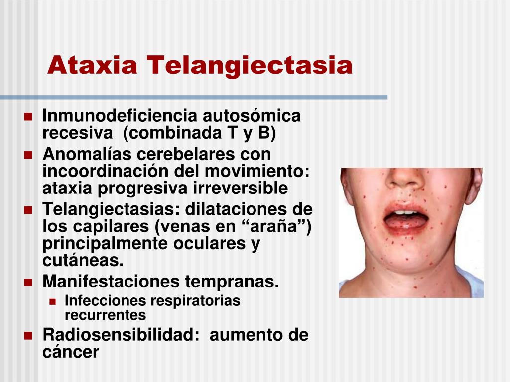 PPT - ETIOLOGIA Y CLINICA DE LAS INMUNODEFICIENCIAS PowerPoint ...
