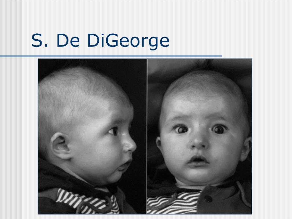 PPT - ETIOLOGIA Y CLINICA DE LAS INMUNODEFICIENCIAS PowerPoint ...