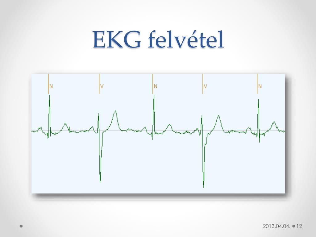 PPT - Számítógéppel támogatott oktatás és kardiológia PowerPoint ...